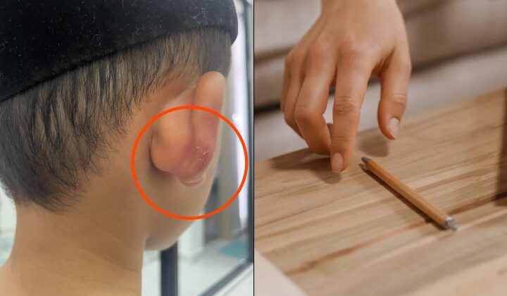 “Sebab Kutip Pensel Bawah Meja Je” – Wanita Dakwa Cikgu Cubit Telinga ...