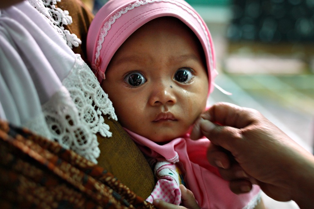 Growing ‘medicalisation Of Female Circumcision In Asia Sparks Risk Warnings