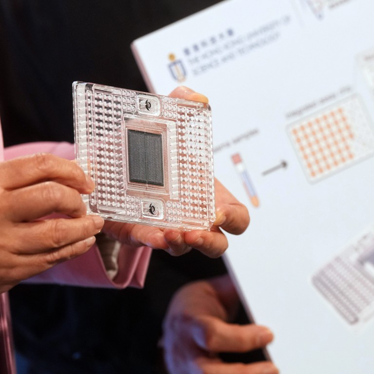 Hong Kong-led team develops blood test that can catch dementia in early ... Hong Kong-led team develops blood test that can catch dementia in early ...