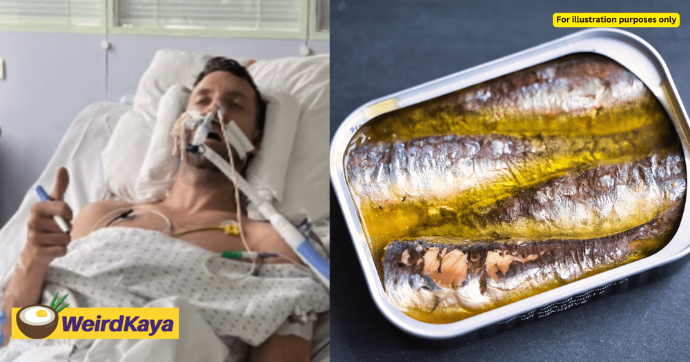 Man Loses Ability To See And Speak After Eating Tainted Sardines In ...