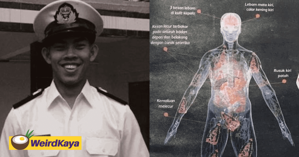 Here’s What You Should Know About Zulfarhan Osman’s Brutal ...