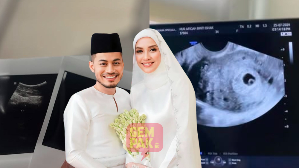 Syafie Naswip Dedah Isteri Alami Keguguran 4 Bulan Lepas - “Al Fatihah ...