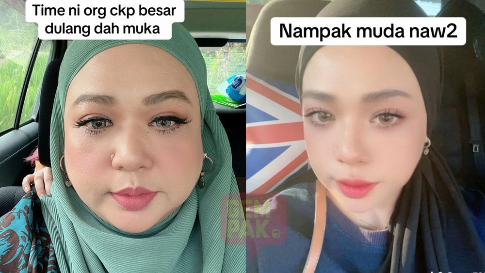 Wajah Semakin Kurus, Enot Buat Ramai Terkejut – “Hampir Tak Cam Lepas Berubah”