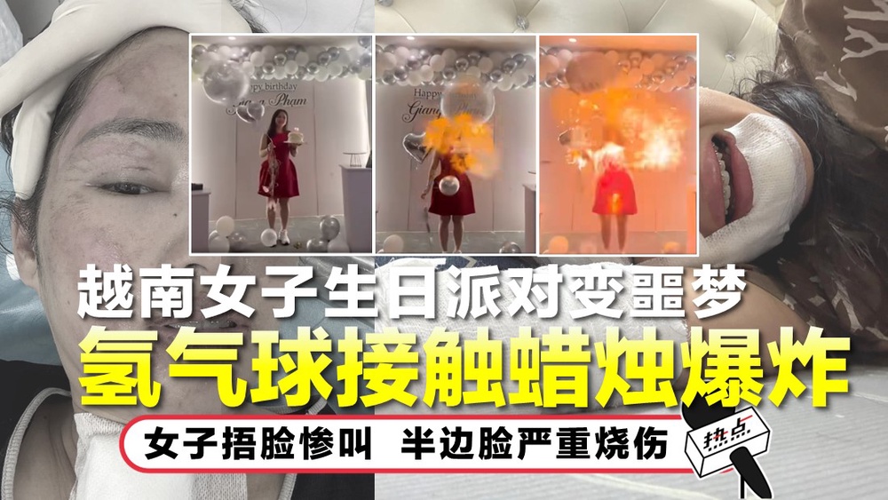 【影片】氢气球变“炸弹”爆炸燃烧！ 越南女子庆祝生日惨破相