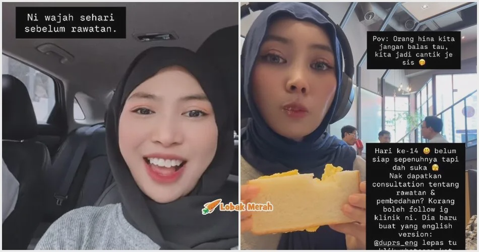 Tayang Perbezaan Sebelum & Selepas ‘Rawatan’, Kim Seri Buat Pembedahan ...