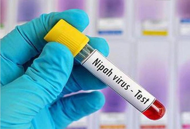 Nipah virus: MOH steps up health controls at all entry points