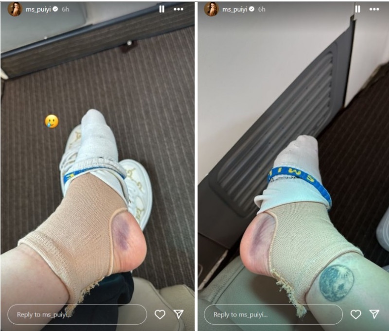 Pui Yi falls down in Bali show days after suing ex-partner