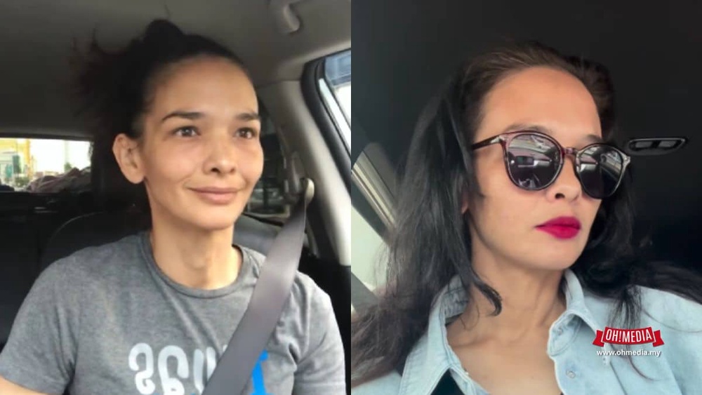 Kongsi Gambar Mata Lebam, Zahnita Wilson Dakwa Jadi Mangsa Keganasan ...