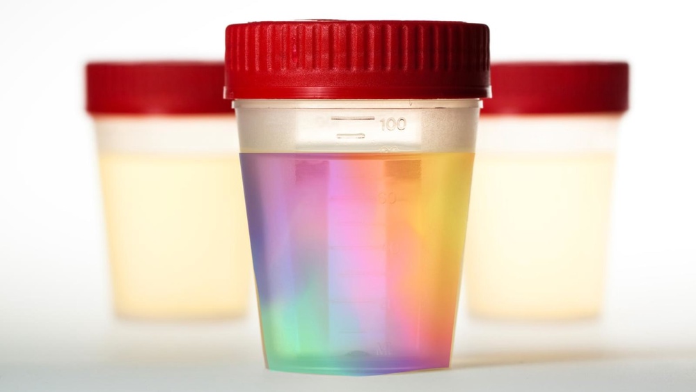 What does the colour of your pee say about your health?