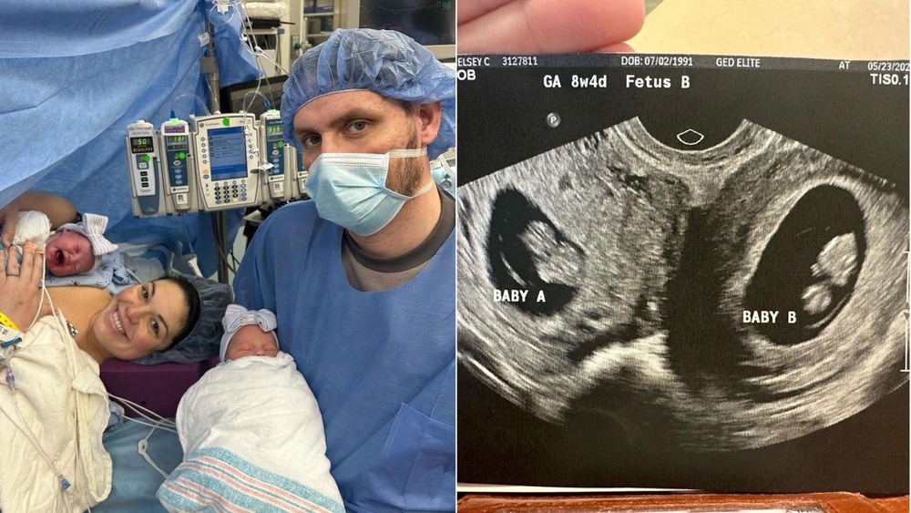 US woman with double uterus gives birth to rare twin girls