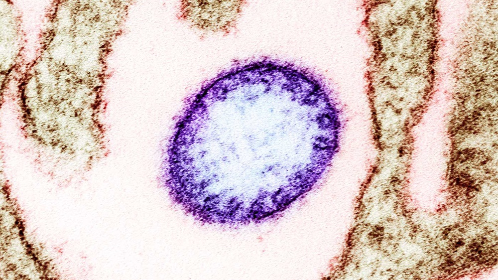 What is the Nipah virus? Two confirmed cases spark airport screening ...