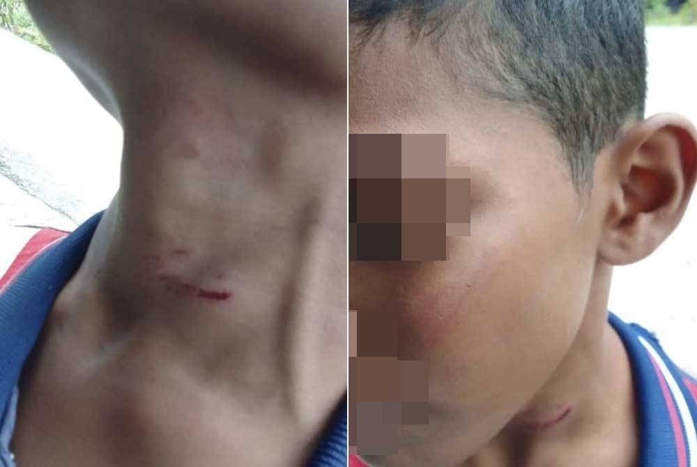 Student sustains facial, bodily injuries allegedly canned by headmistress