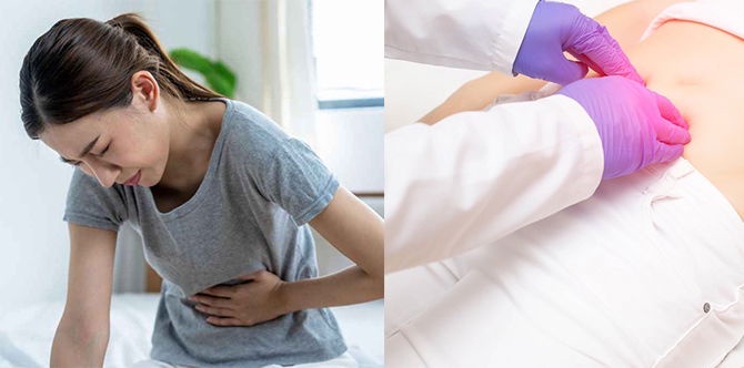 Penyakit Hernia Pada Perempuan: Apa Itu Hernia Atau Angin Pasang ...