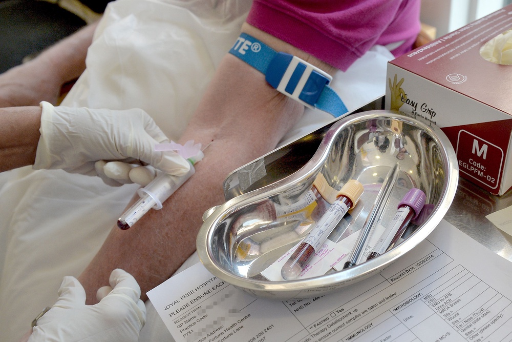 Blood test detecting 12 cancers at an early stage receives government ...