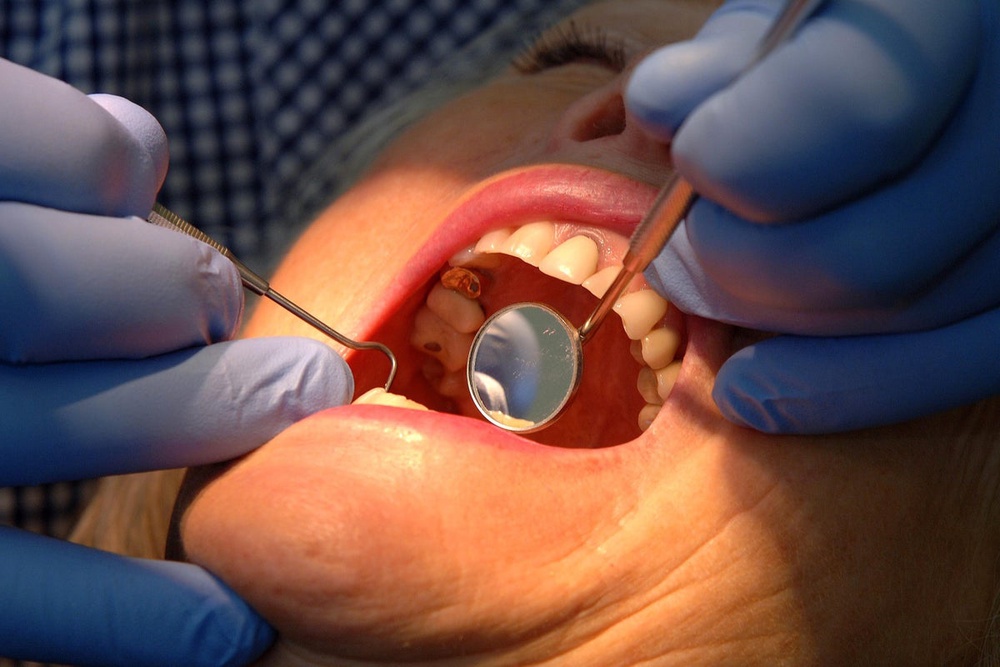 The lab-grown teeth that could change dentistry forever