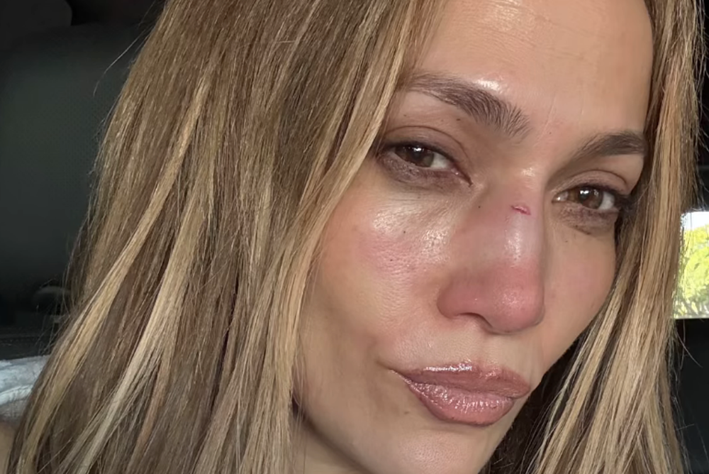Jennifer Lopez gives health update after onstage injury that led to ...