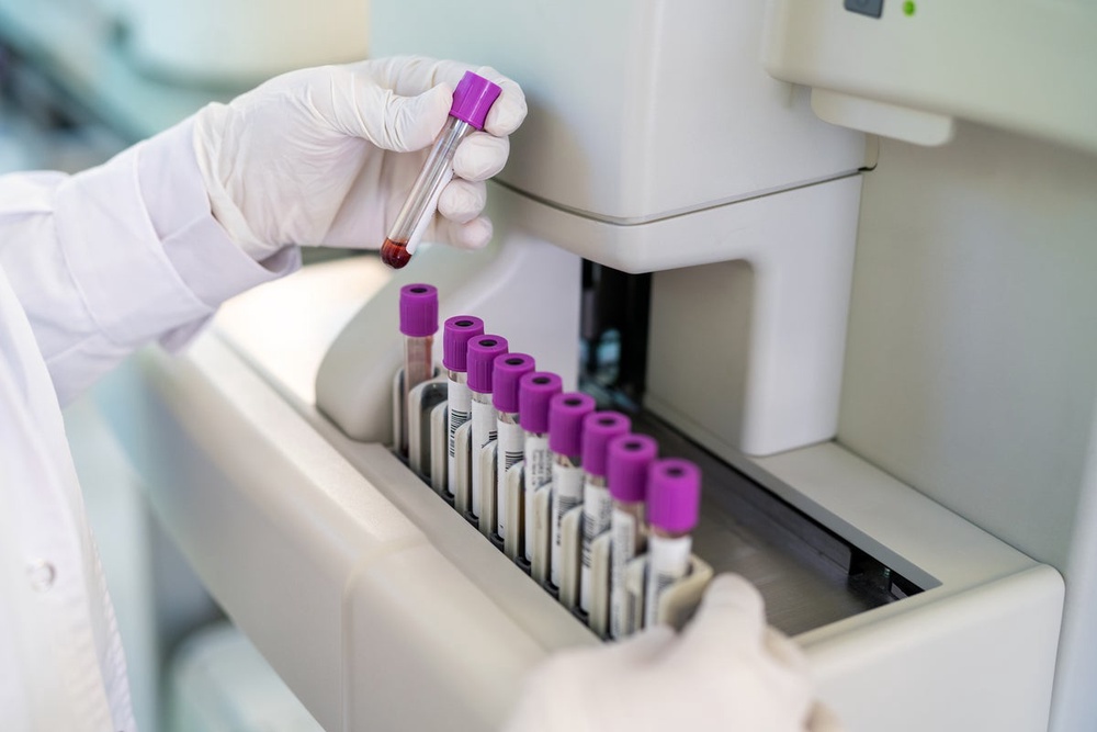 New blood test could transform chronic fatigue syndrome diagnosis