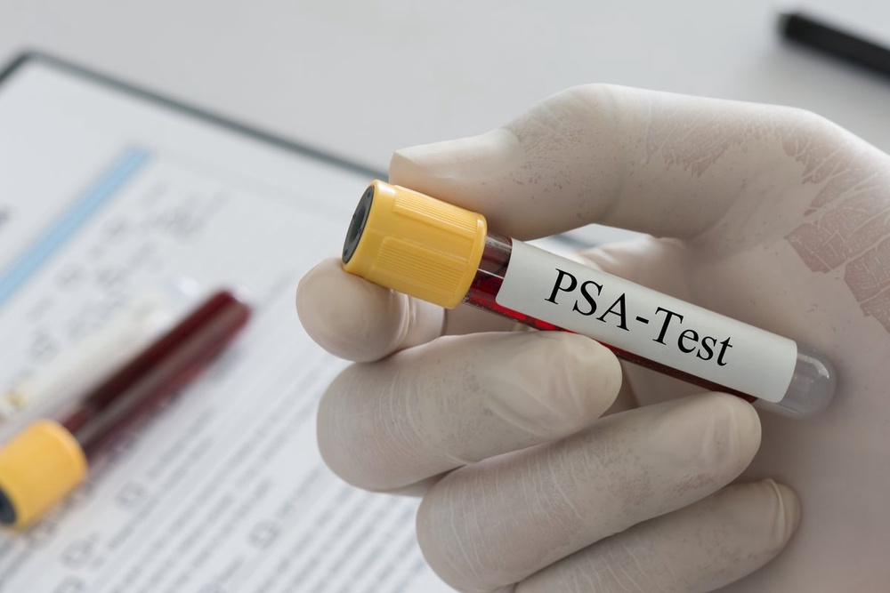 Watchdog bans ads for at-home prostate cancer testing kits and supplements
