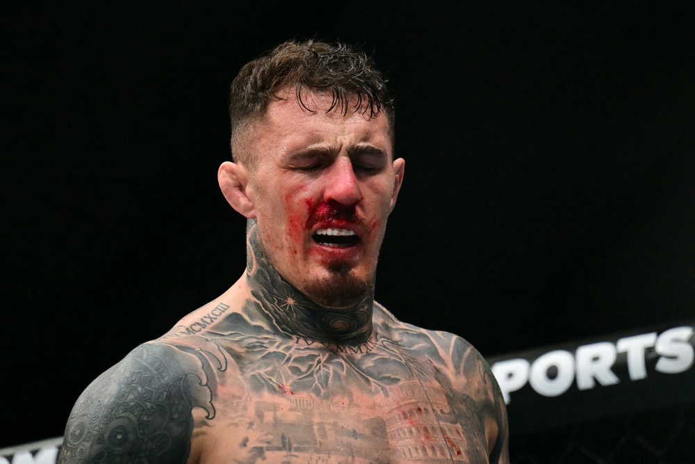 UFC referee reveals Tom Aspinall eye poke could force rule change