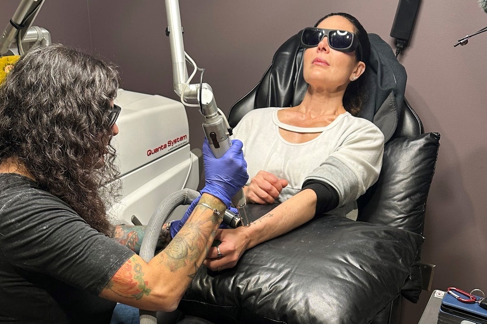 What it’s really like to have a tattoo burnt off you – and how much it ...