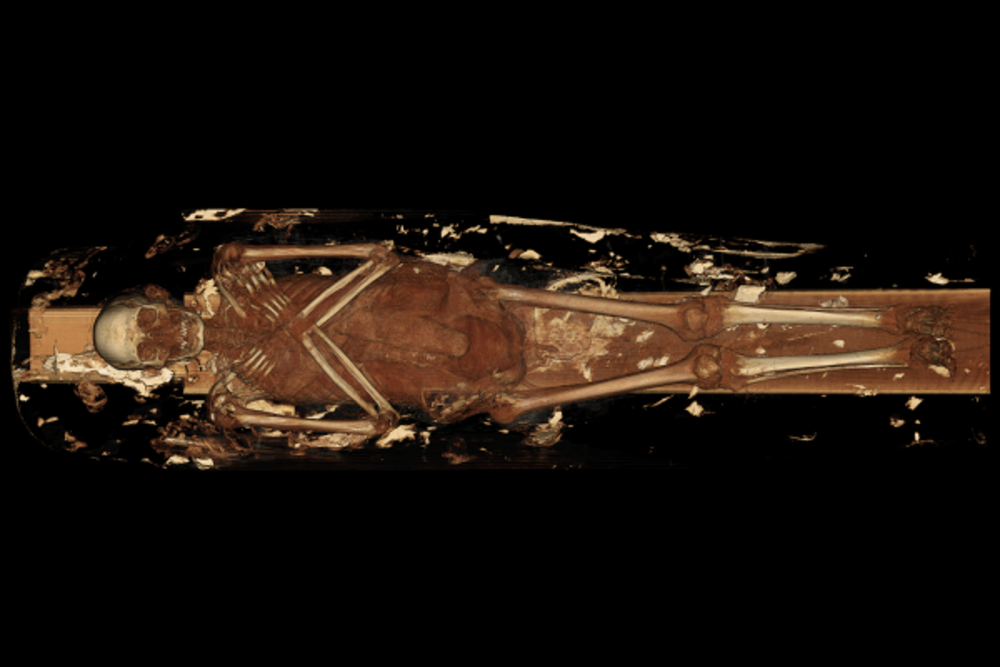 Scans of 2,000-year-old mummy show ancient Egyptian lived with back pain