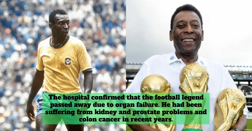 Brazilian Football Legend Pelé Passed Away At The Age Of 82