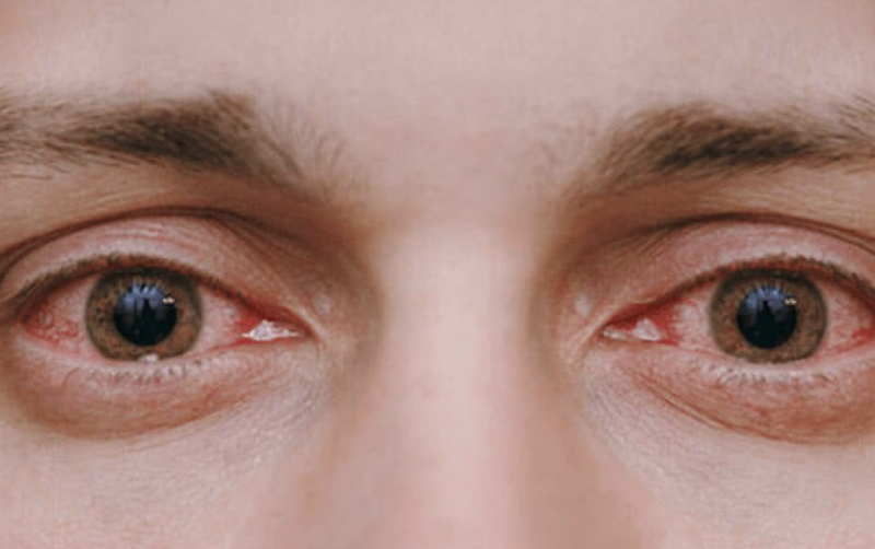 Pfizer Vaccine & Eye Health: What a Turkish Study Actually Found