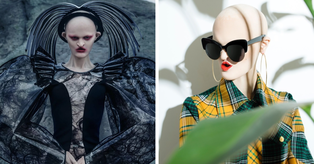70 Photos Of Melanie Gaydos, A Successful Model With A Rare Genetic ...
