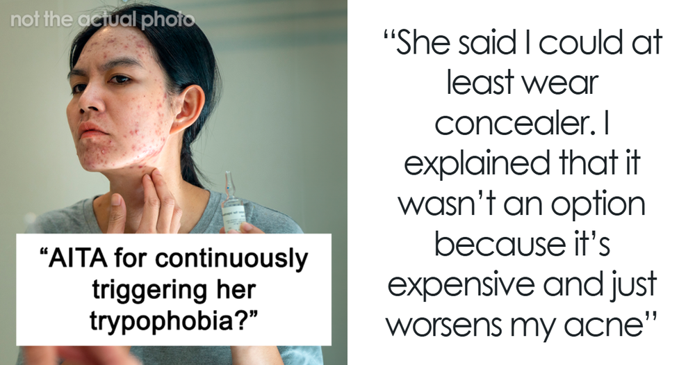 Student’s Acne Causes Classmate’s Panic Attacks, Teacher And Friends ...