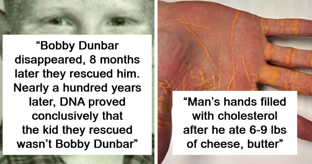 “Oddly Horrifying”: 50 Of The Most Unnerving Images That Might Freak ...