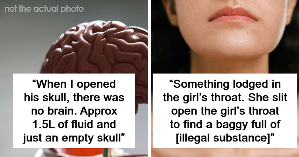 47 Autopsy Experts Reveal Their Weirdest And Most Unique Finds: “There ...