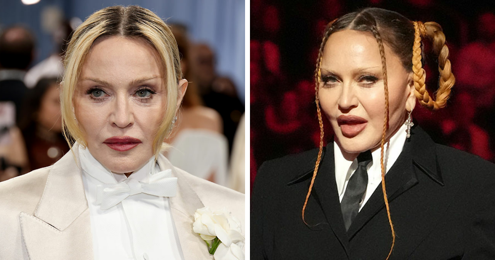 66YO Madonna Brings Back Natural Look At Met Gala 2025 After Concerning ...