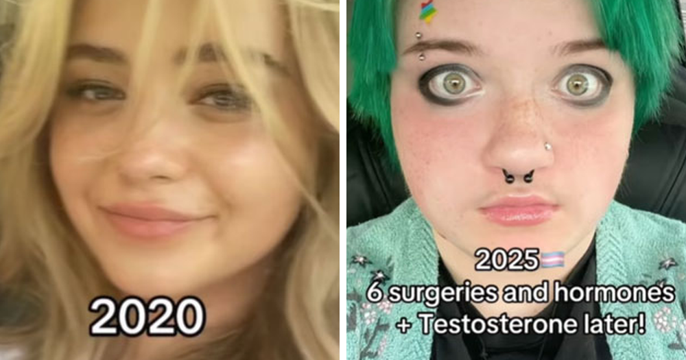 33 Then-And-Now Pics Of People Who Experienced A “Glow-Down” Transformation