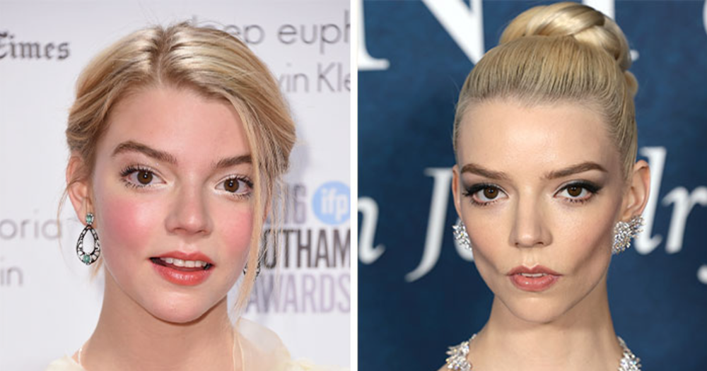 25 Celebrities Fans Believe Ruined Their Beauty With Buccal Fat Removal