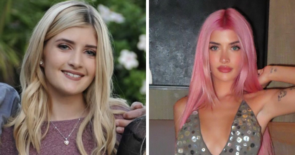 Charlie Sheen’s Daughter Posts Shocking Before-And-After Photos ...