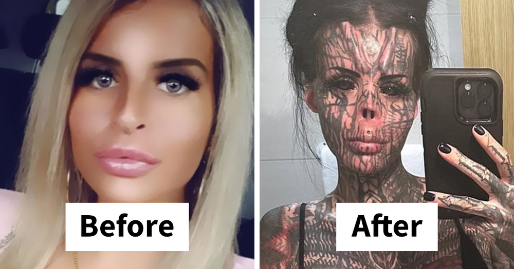 Tattooed Woman Opens Up About Cutting Off Her Nose And Shares Before ...