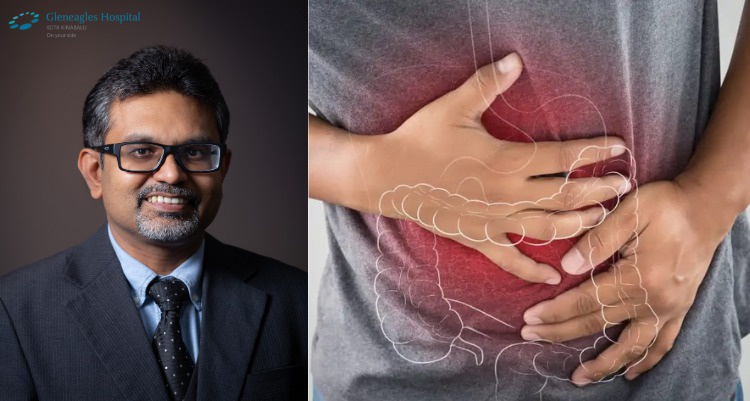 Colorectal cancer: Fighting a hidden menace