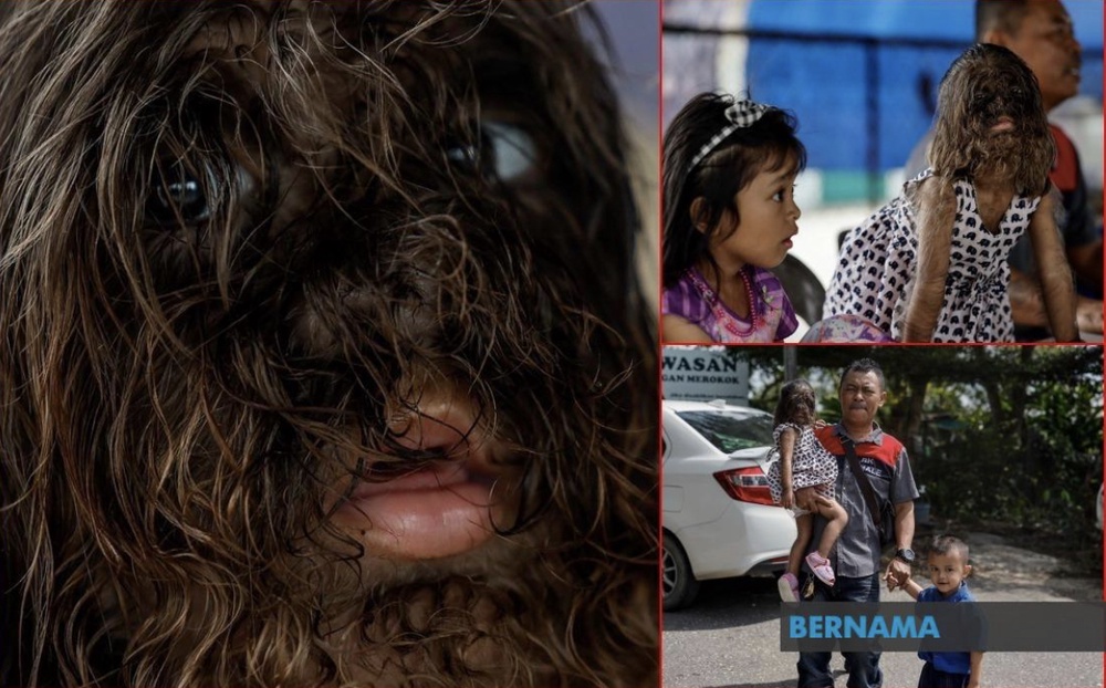 Werewolf child: Father cherishes King’s advice